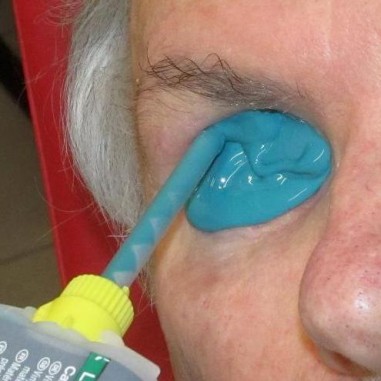 HOW WE MAKE AN OCULAR PROSTHESIS | Dalpasso protesi oculari